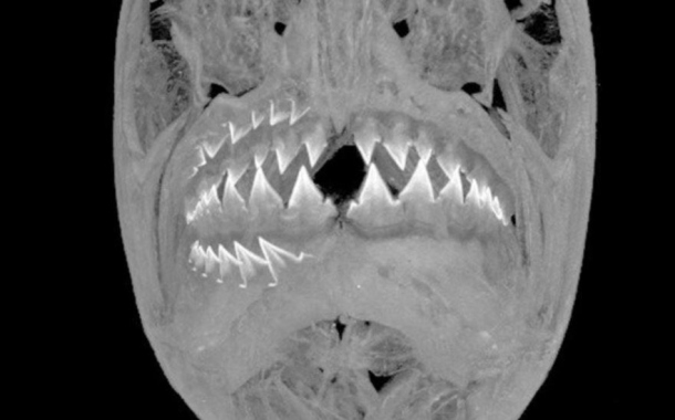 Piranha teeth are even more incredible than we thought – Authcom